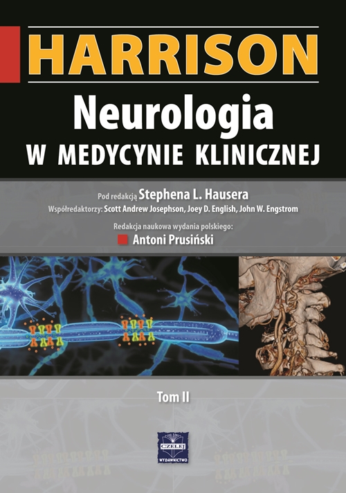 Harrison. Neurologia w medycynie klinicznej. Tom II.
